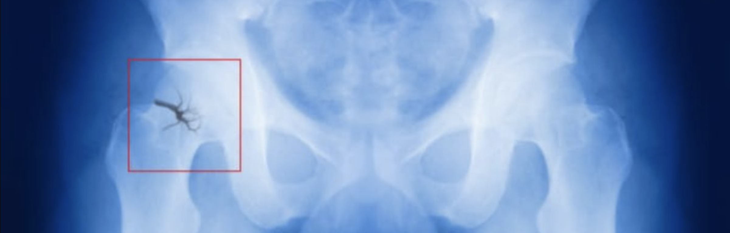 Blog Archives - Cielito Lindo Senior Living